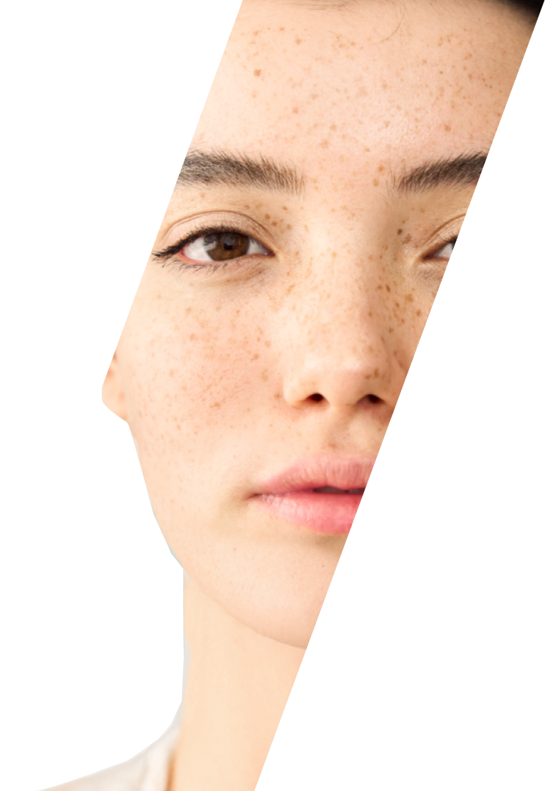 Bruno Vision Care | FDA-Approved Deseyne® Contact Lenses for Dry Eyes